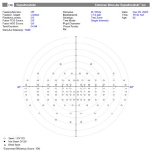 Are You Fit to Drive? Visual Requirements for Drivers in Australia - Dr ...