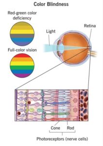 Understanding Colour Blindness: Causes, Types & Symptoms - Dr. Chameen Sams